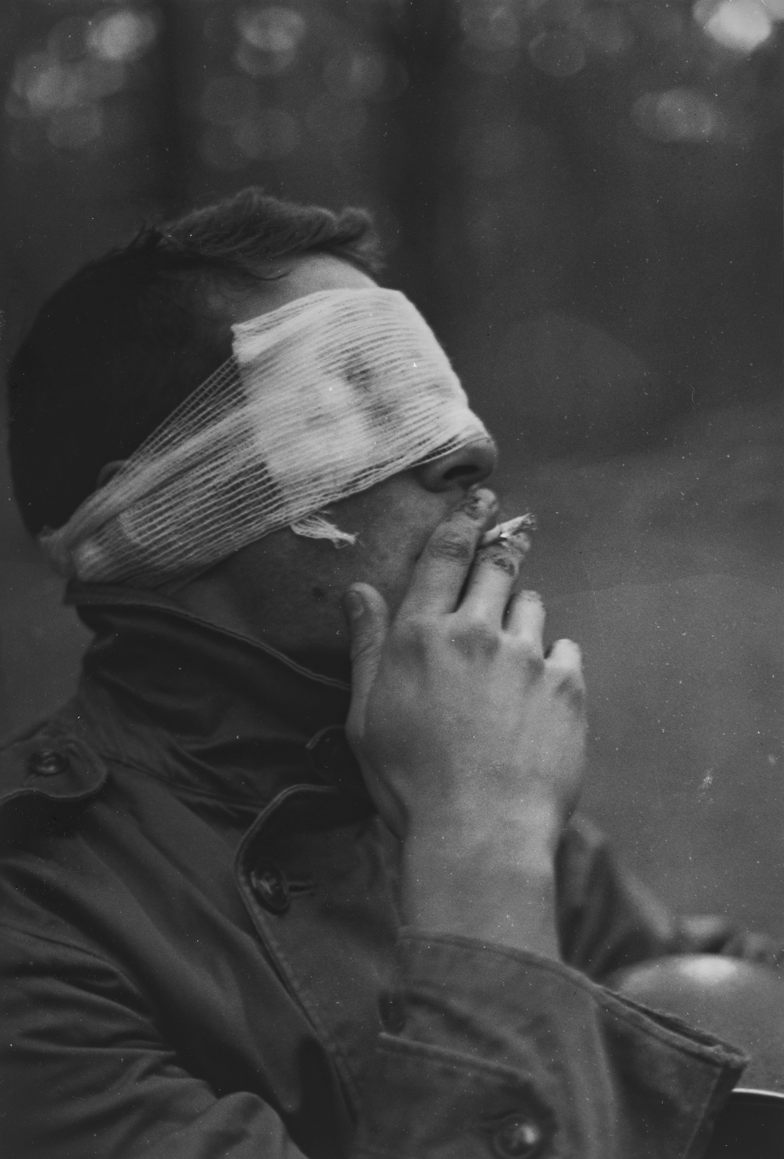 Robert Capa - Normandy, Portrait of blindfolded soldier 1944 ...